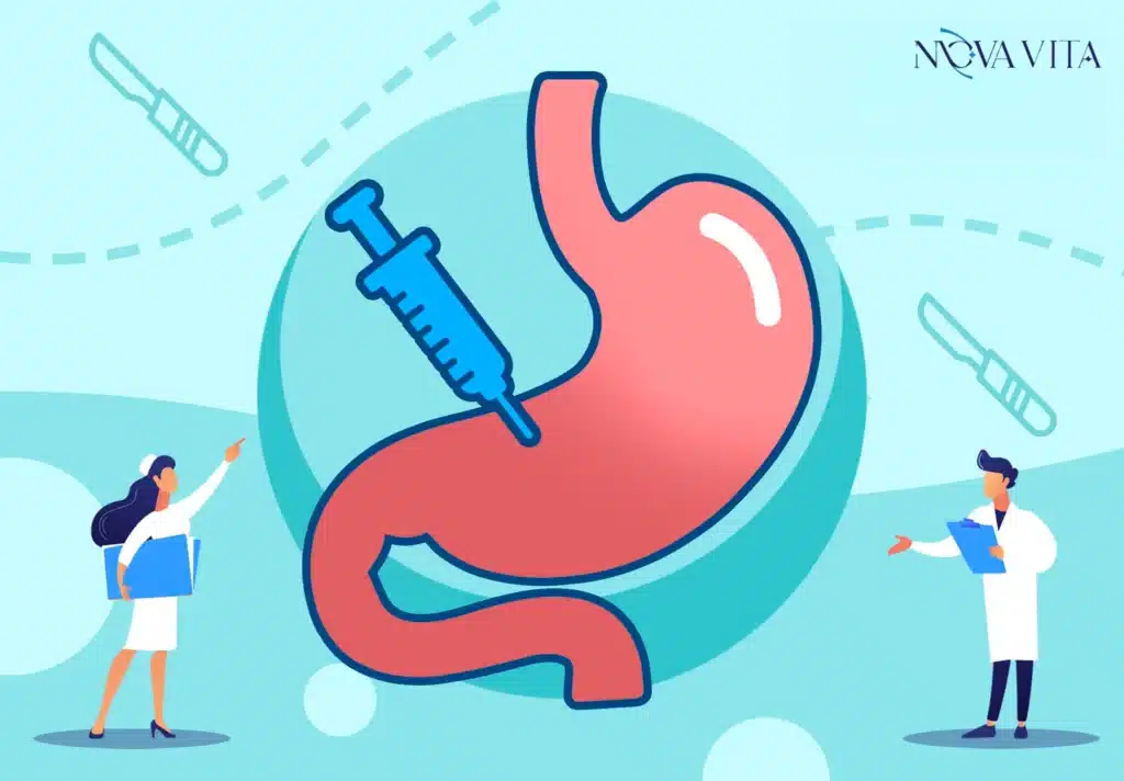 Gastric Botox - Nova Vita Clinic